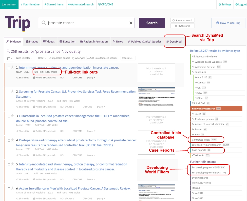 Evidencias Medicas : Changes in Tripdatabase Medicina General y Familiar