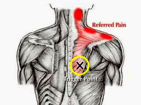 Body matters: DIY Acupressure | Shoulder blade | Rhomboid pain relief
