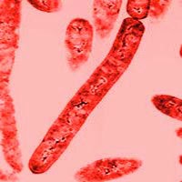 La magia de los OVNIS: Arqueobacterias