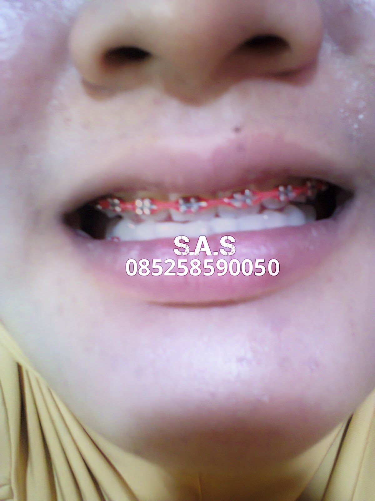 S.A.S - AHLI GIGI KOTA PATI, Jateng & KOTA JEMBER, Jatim: Si Cantik dan ...