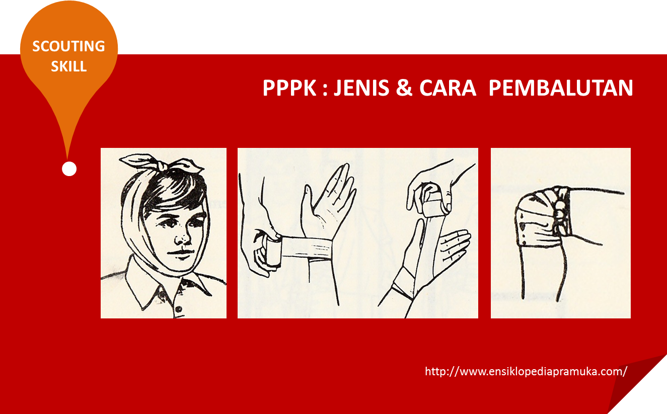 Sejarah Pramuka: PPPK : Jenis dan Cara Pembalutan