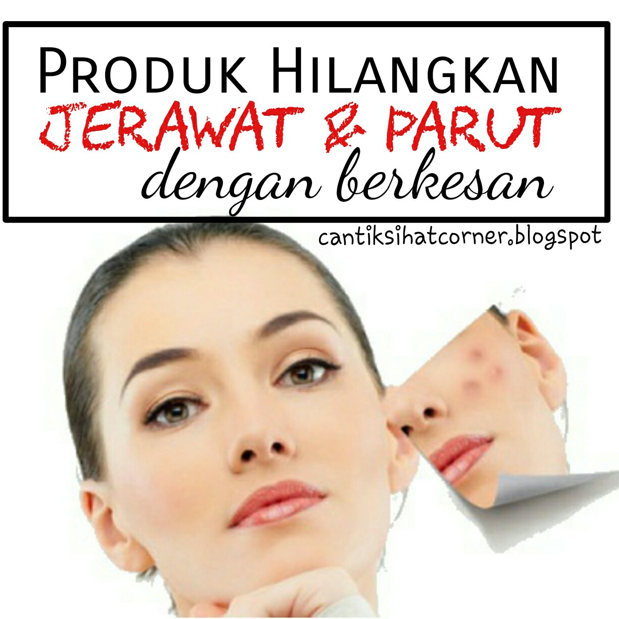Produk Hilangkan Jerawat dan Parut Degil Dengan Berkesan - Cantik Sihat ...