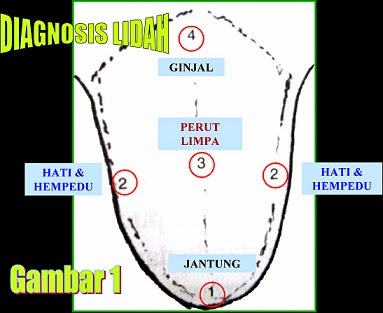 Rumah Sehat Al Syifa: Diagnosa Penyakit Melalui Lidah