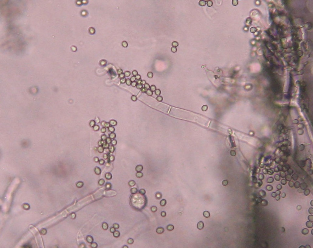 TAMU_PLPA631_FungalBlog_LornaNissen: Lab 6