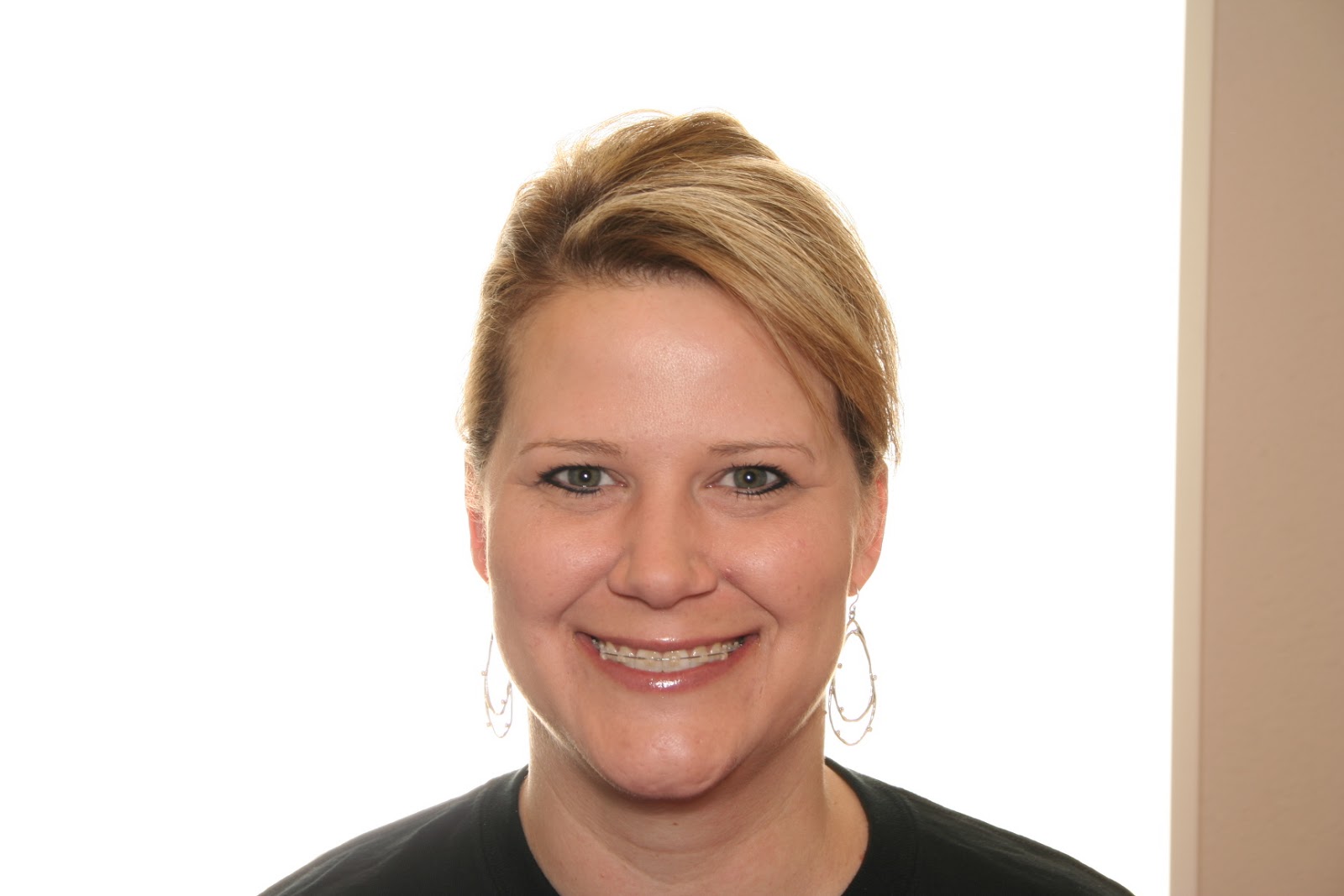 St Clair Orthodontics, Damon braces, Invisalign