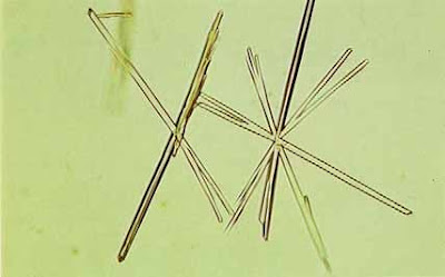 [Haematology] Microscopic Examination of Urinary Sediment - Crystals ...