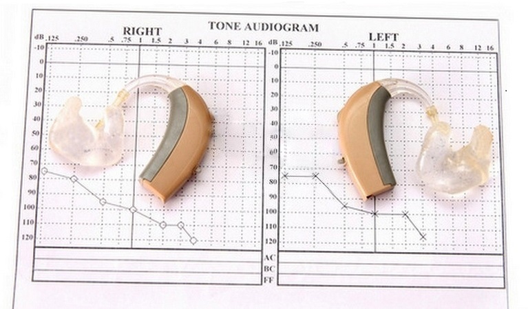 ¿Qué es un audiograma? ~ Info Acúfeno