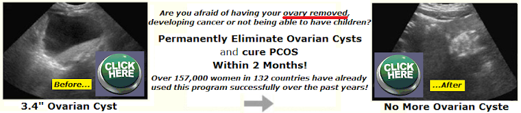 Ovarian Cyst: 2 cm ovarian cyst pain