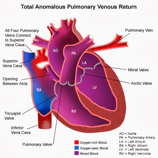 ER goldbook: Congenital heart disease I: Cyanosis