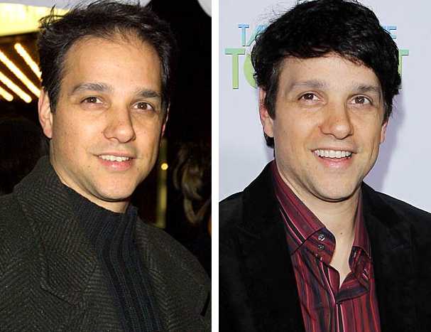 Ralph Macchio Hair Transplant