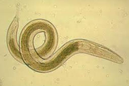 Cacing yang menyebabkan rasa gatal pada dubur dimalam hari adalah....