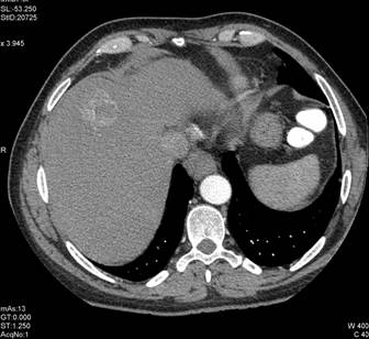 Las TAC: las has visto pero, sabes que son...?