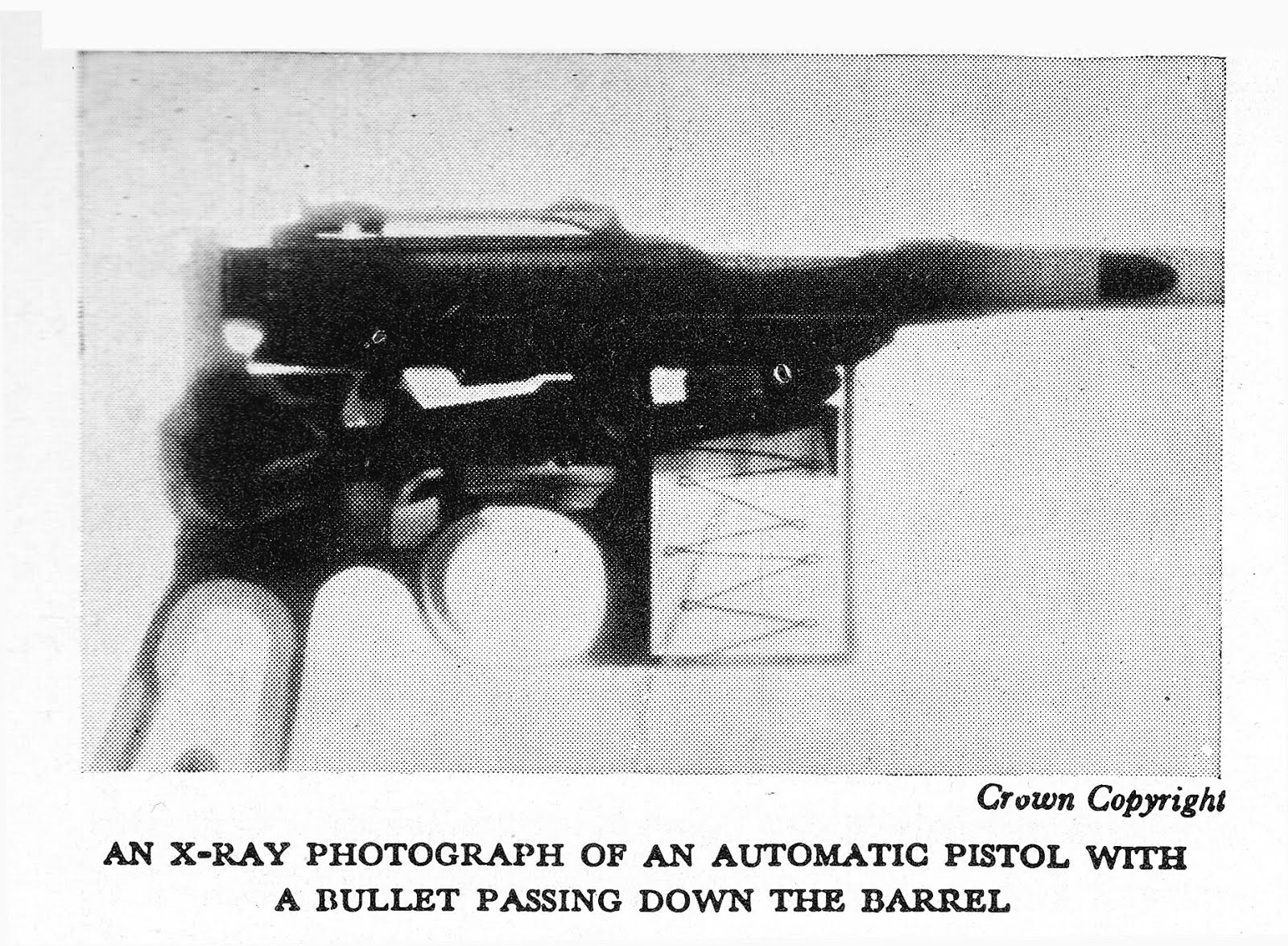 Progress is fine, but it's gone on for too long.: X-Ray of an automatic ...