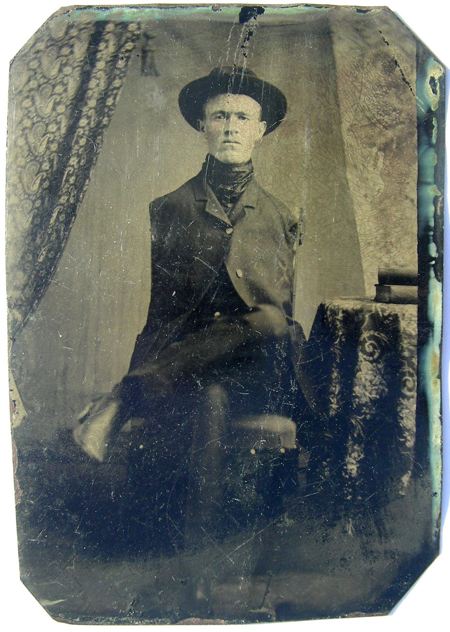 Anonymous Works: Portrait of an Armless Man