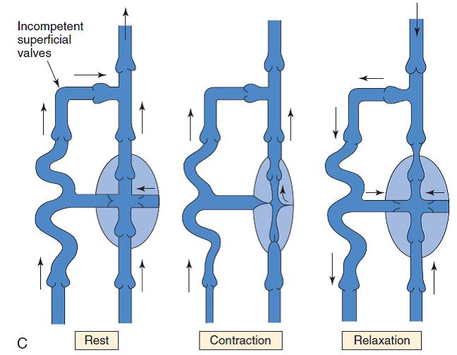 Vascular Mind : DYNAMICS OF VENOUS FLOW IN A NORMAL AND ABNORMAL LIMB