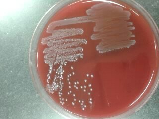 Microbiology EJournal: Day 16-Started PEA,CNA,Mannitol Salt,MacConkley ...