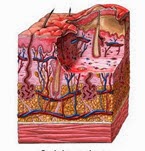 SISTEM INTEGUMENT DENGAN COMBUSTIO/ LUKA BAKAR ~ Ns Retno Ariyani
