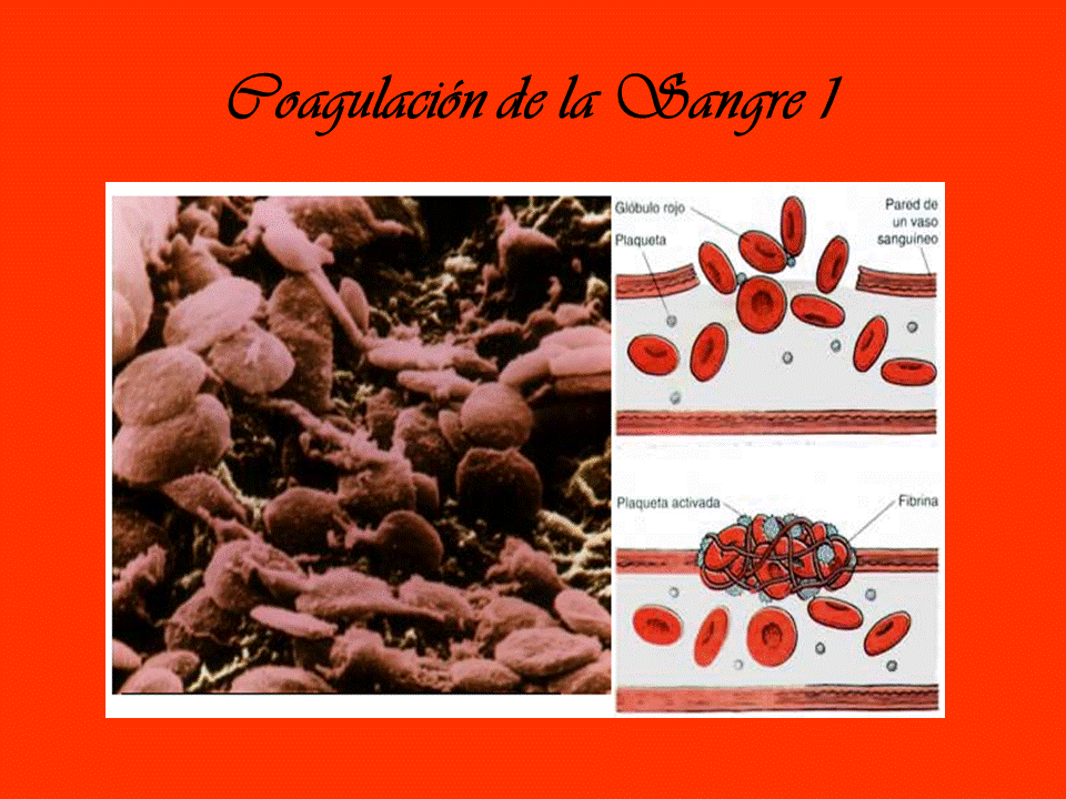Mi1012: PLAQUETAS, COAGULACION Y FIBRINOLISIS