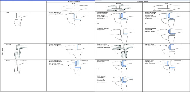 骨科筆記: TOTAL KNEE FLEX/EXTENSION GAP