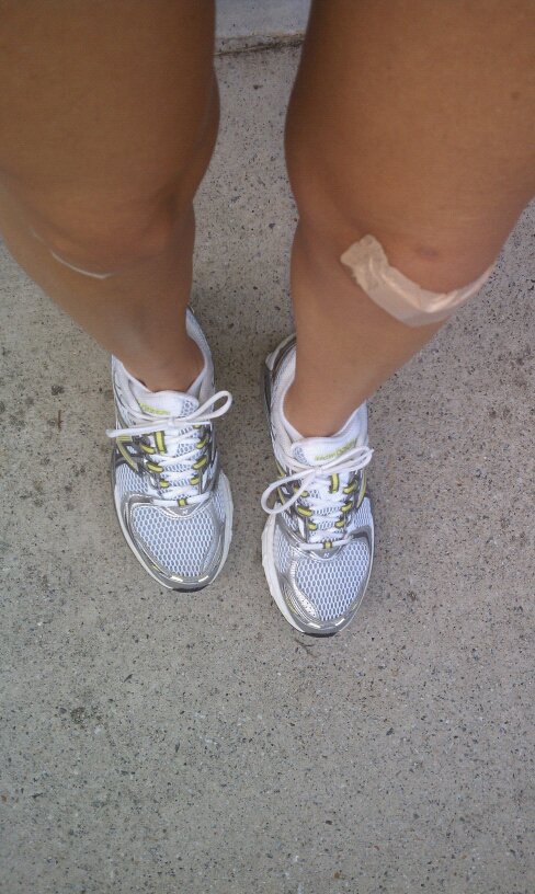 Matrale Madness: Busted Knees!