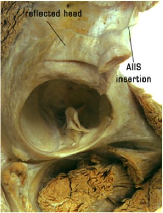 整形外科リハビリテーション学会京都支部スタッフブログ: Rectus femoris reflected headの解剖