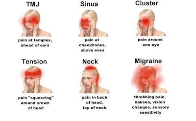 Aprenda a reconocer qué tipos de dolores de cabeza son peligrosos y ...