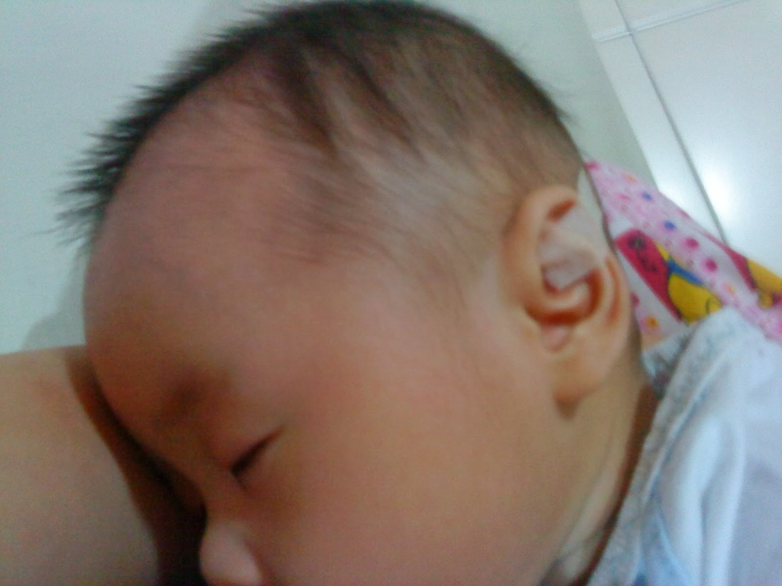 Cilipadi: Baby Ear splinting for Pointy Ears