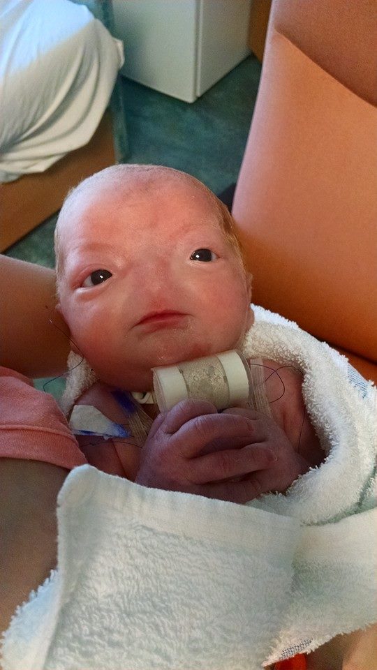 A baby was born without nose - Nepali Viral
