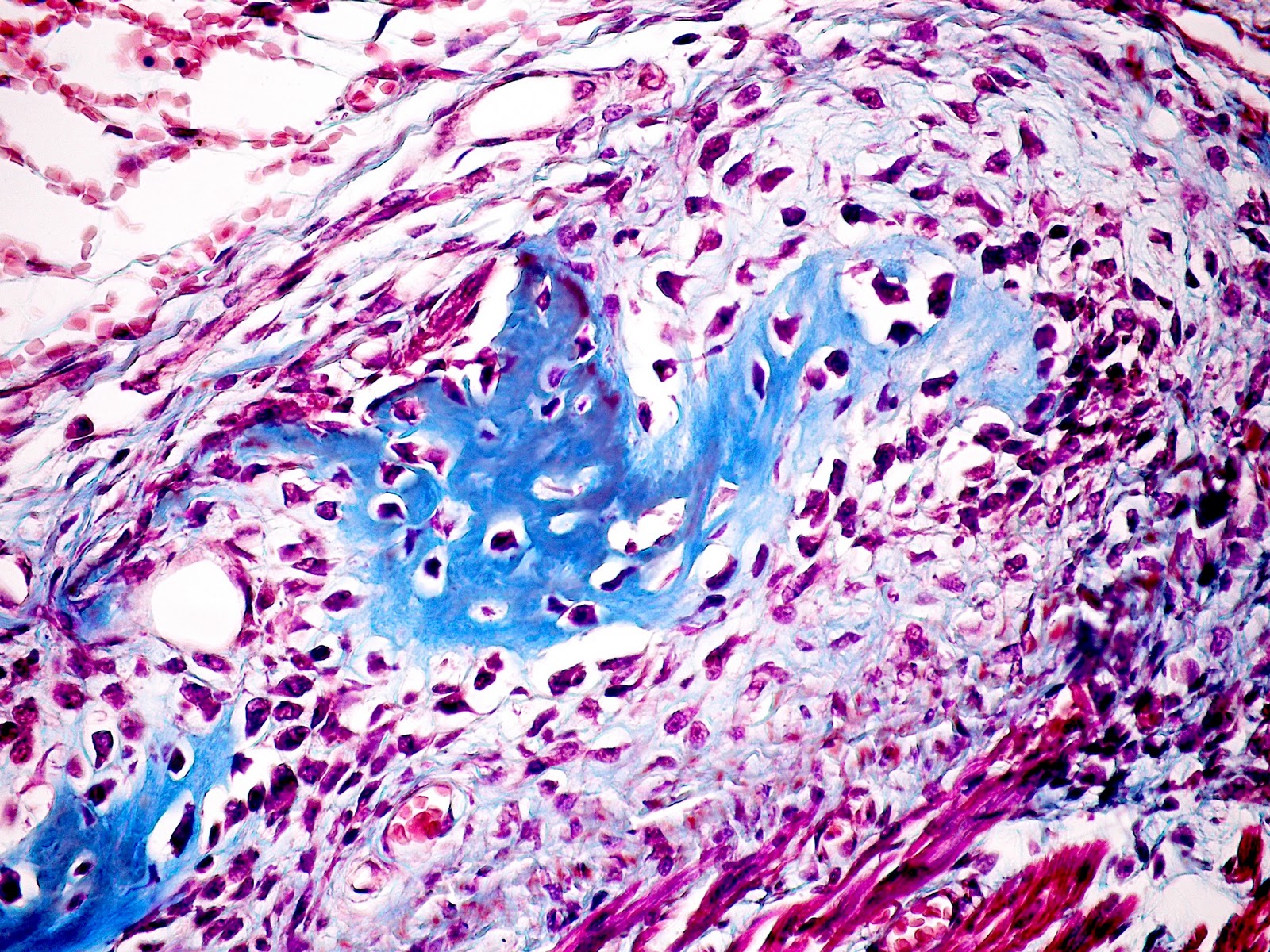 SOS BIOLOGIA CELULAR Y TISULAR: TEJIDO OSEO. OSIFICACION. Bone tissue ...