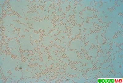 [Microbiology] Atlas of Anaerobes of Clinical Importance | Free Medical ...