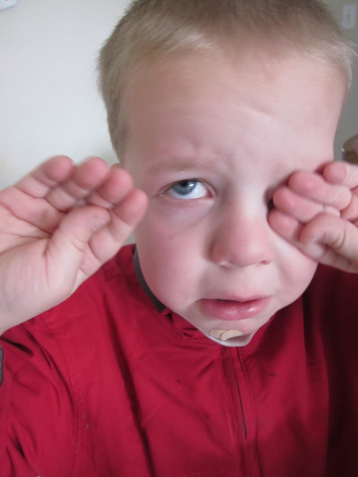 Life Happens: The chin that cracked