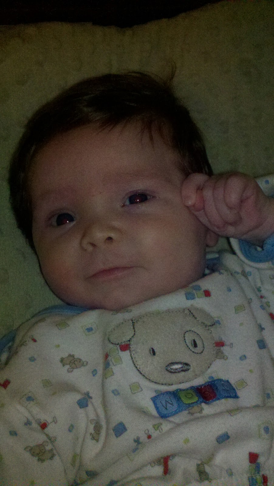 Our son and Trisomy 16p 11.2 duplication