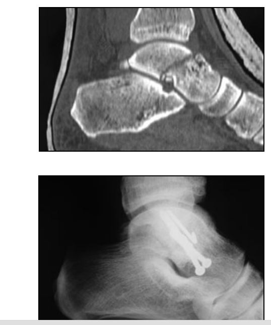 Un médecin du sport vous informe: 02.10.2013
