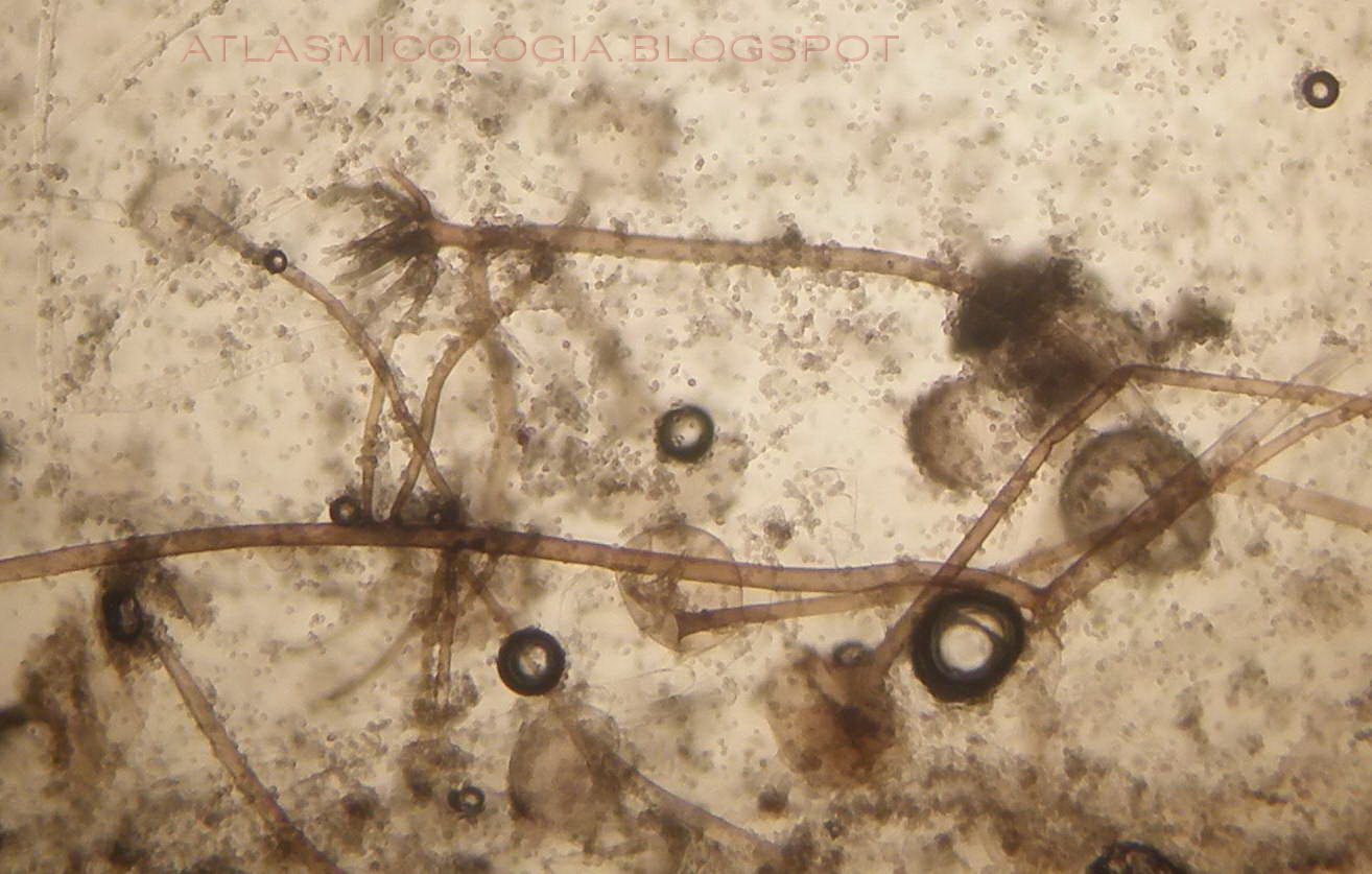 ATLAS MICOLOGIA: RHIZOPUS SP.