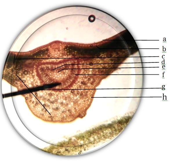 Biology for Life: Stained Coleus stem C.S. and Ixora leaf C.S.under ...