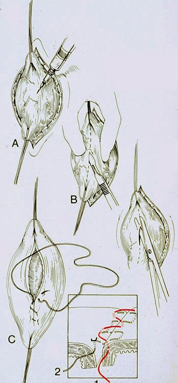 Teknik Operasi Cystotomy pada Hewan - Mydokterhewan