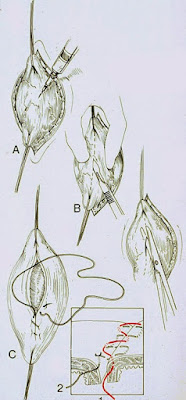 Teknik Operasi Cystotomy pada Hewan - Mydokterhewan