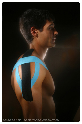Tom's Physiotherapy Blog: Kinesio Taping: A Sceptic's View