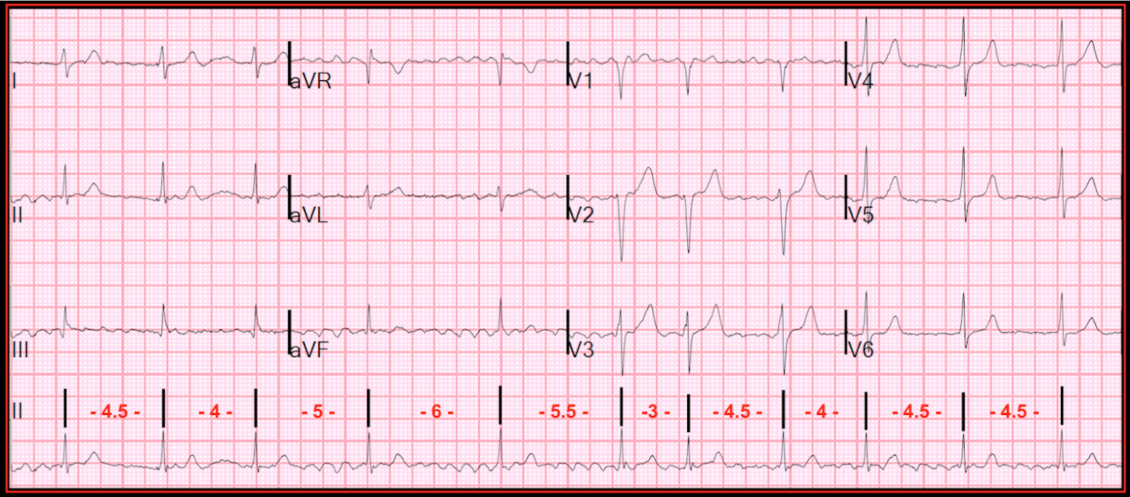 Dr. Smith's ECG Blog