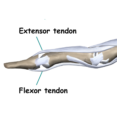 MYO Therapy & Healthcare Institute: Flexor Tendon Injuires