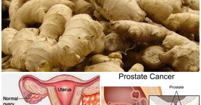 Ginger Forces Cancer Cell Death More Effectively Than Chemotherapy (How ...