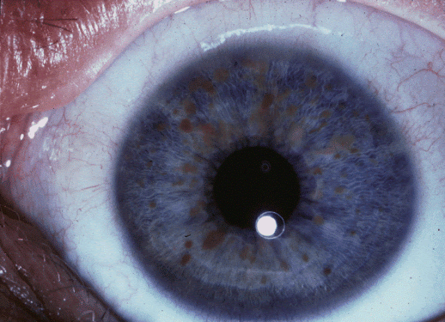 EL RINCÓN DE LA MEDICINA INTERNA. juanpedromacaluso@yahoo.com.ar ...