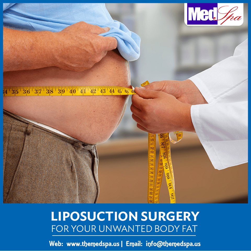 Liposuction in Delhi–All that you need to know