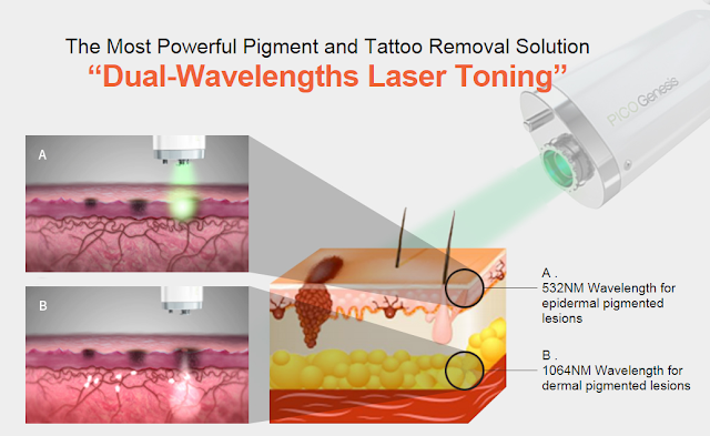 Renewme Skin Clinic: Most Advanced Pico and Nano Enlighten laser for ...
