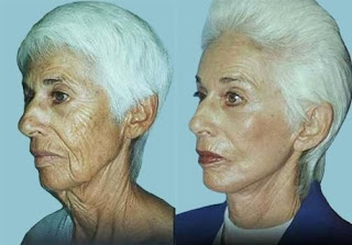 Facial Aerobics For A Sharper, Younger Face: Yoga For The Face Tips ...