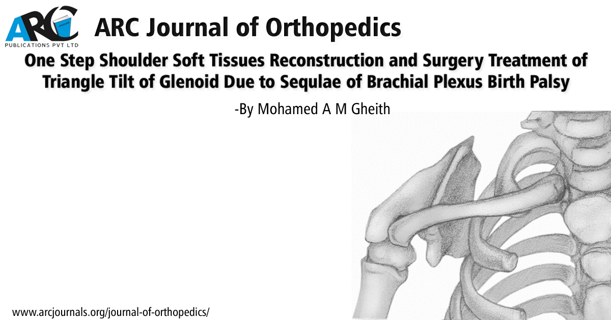 One Step Shoulder Soft Tissues Reconstruction and Surgery Treatment of ...