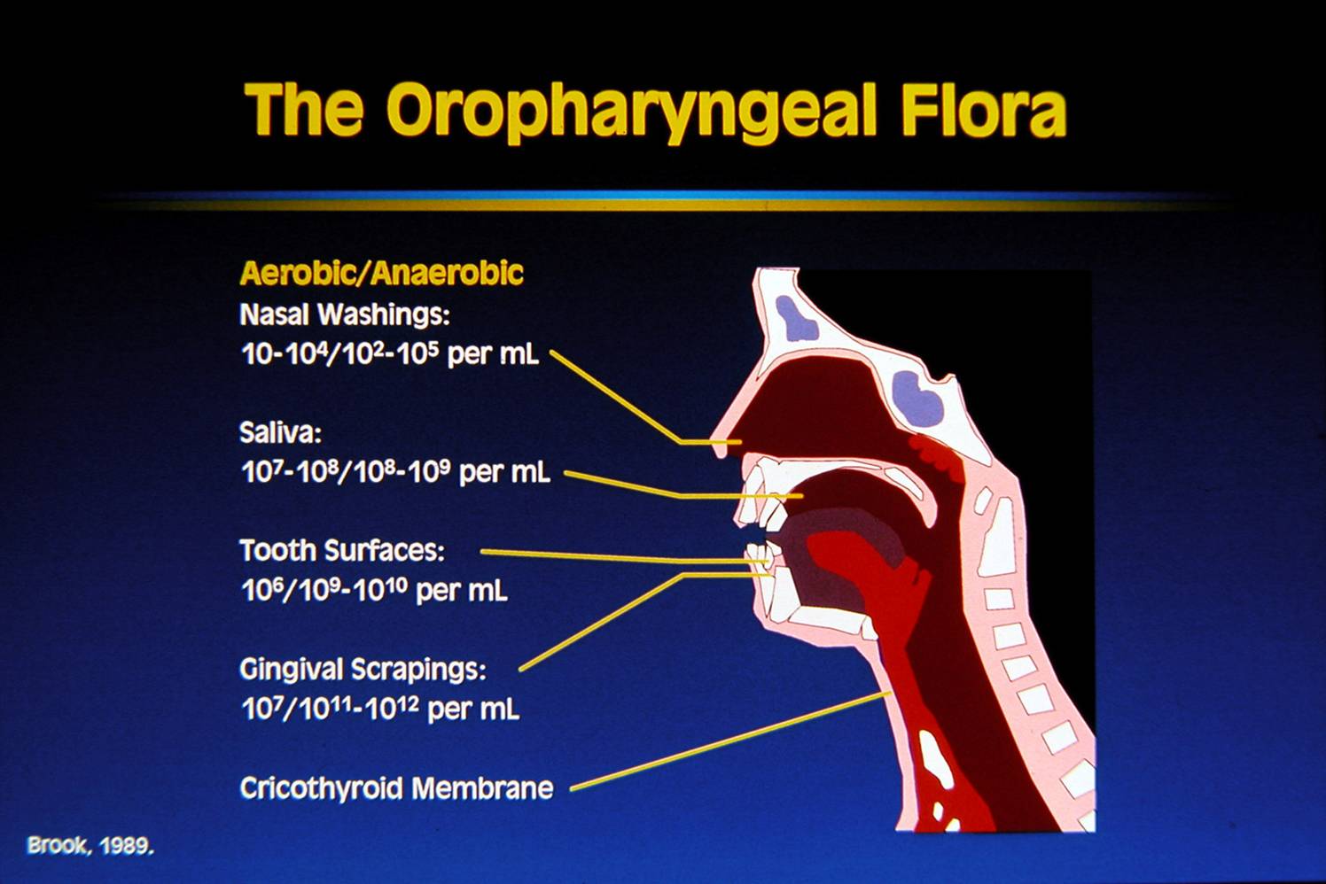 Sinusitis Understood: Infectious Causes (Viruses, Bacteria, Fungi) of ...