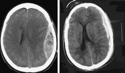Taysir assistance الإسعاف الطبي تيسير: Scanner cérébral sans injection