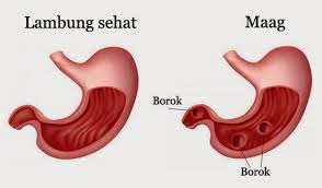 Diet Lambung ~ MOOD FOODY