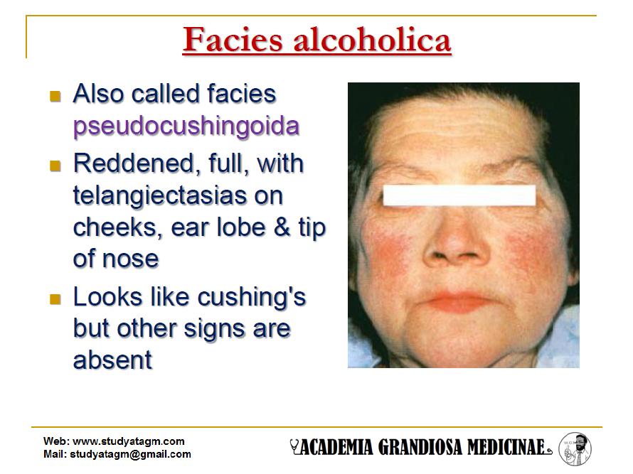 Dr.Harii's Case Discussions & Differential Diagnoses